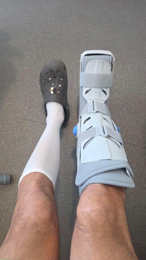 NWB (Non Weight Bearing) | RockAroundTheWorld